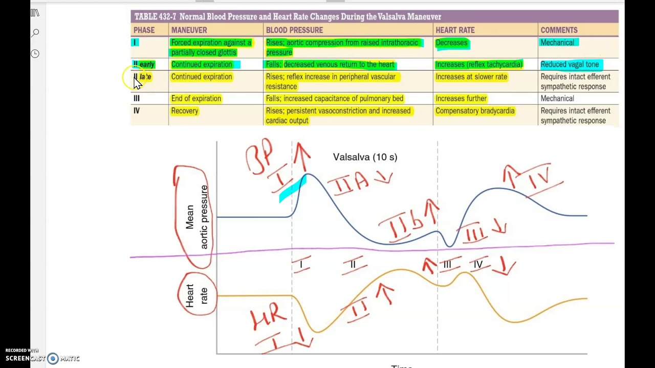 Valsalva maneuver - YouTube