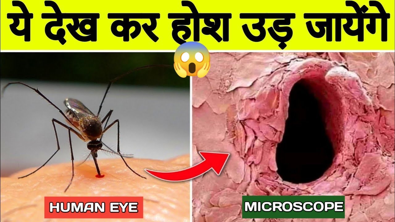 15 things you can see under microscope only || #uniquegyanmasala - YouTube