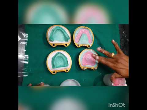 Compression molding technique for denture fabrication - YouTube