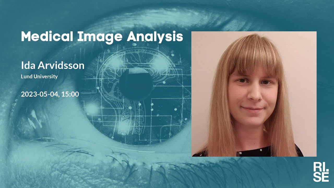 Ida Arvidsson: Applications of AI in Medical Image Analysis - YouTube