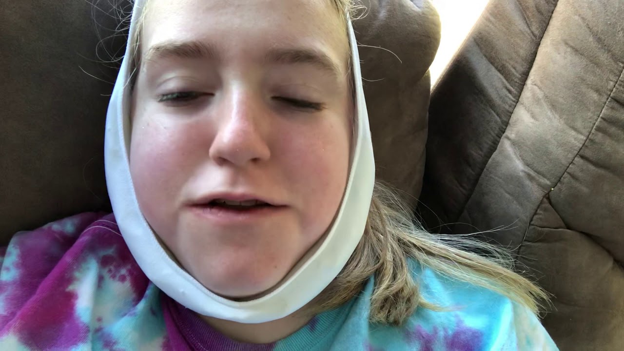 Most hilarious wisdom teeth video EVER! - YouTube