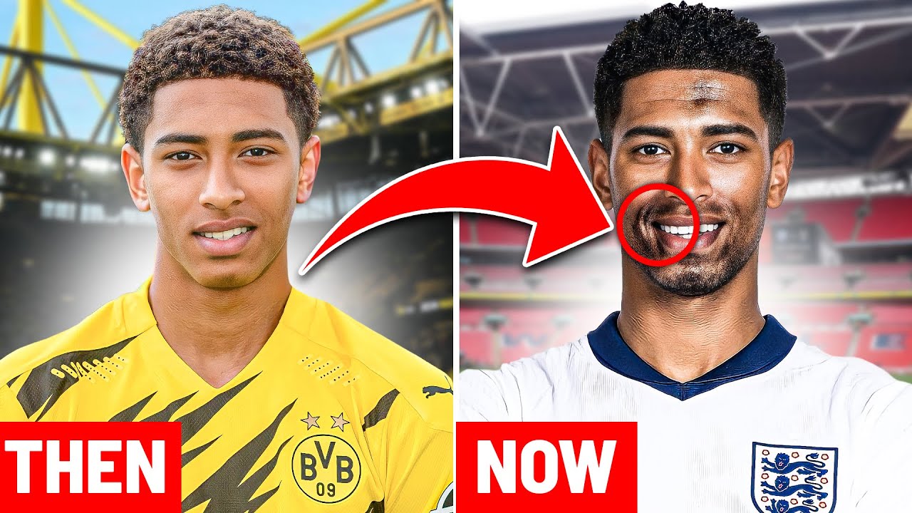 What Has Happened To Jude Bellingham's SKIN? *Explained* - YouTube