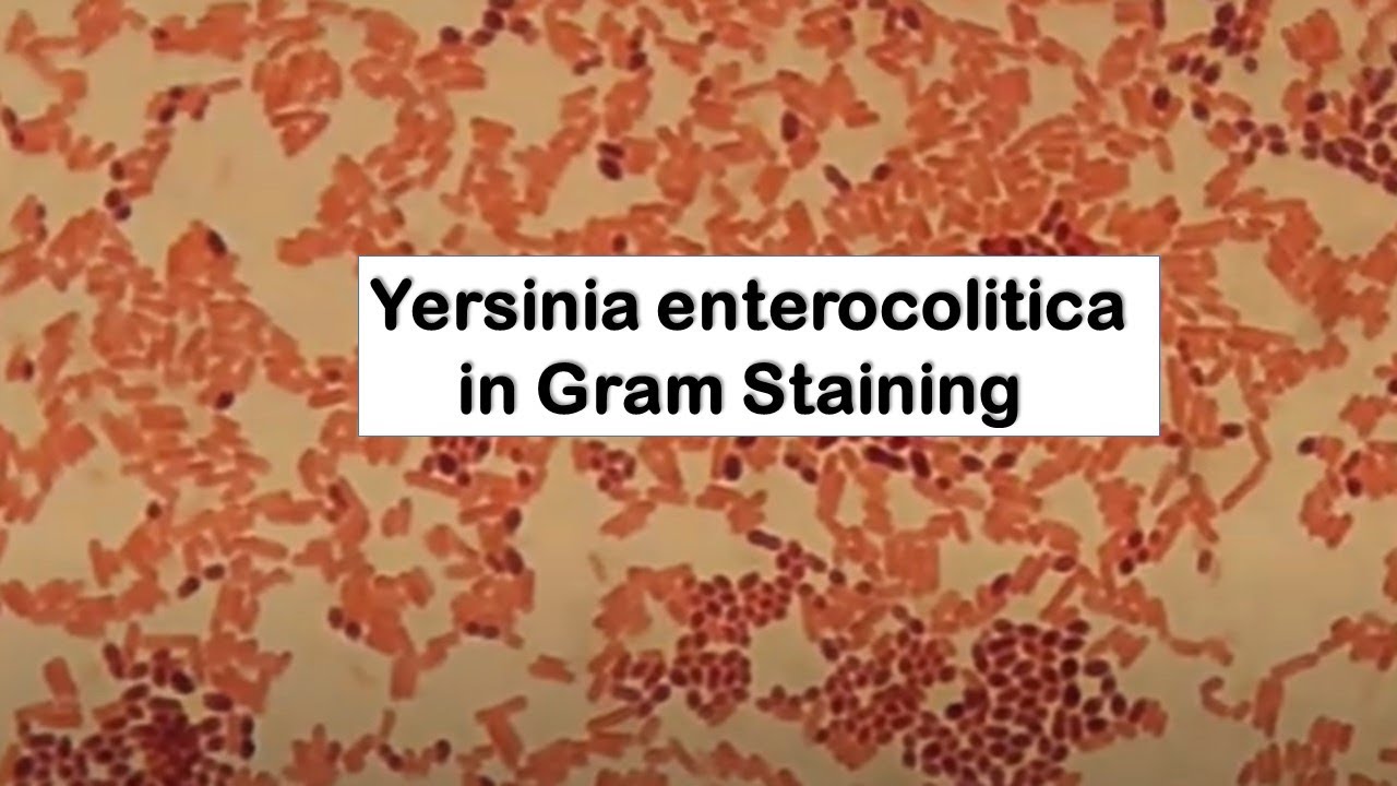 Gram Negative Rods of Yersinia enterocolitica - YouTube