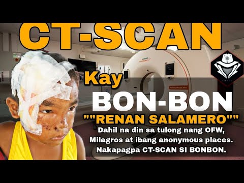 Moment of BON-BON ( CT SCAN) - YouTube