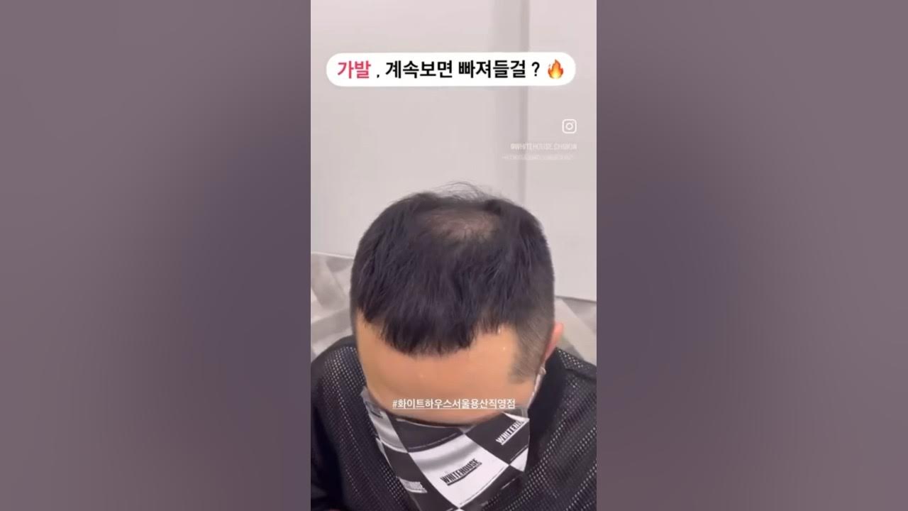 명품 ‘가발 ️ 남자가발 부분가발 남성가발 가발잘하는곳 서울가발 당일가발 Youtube