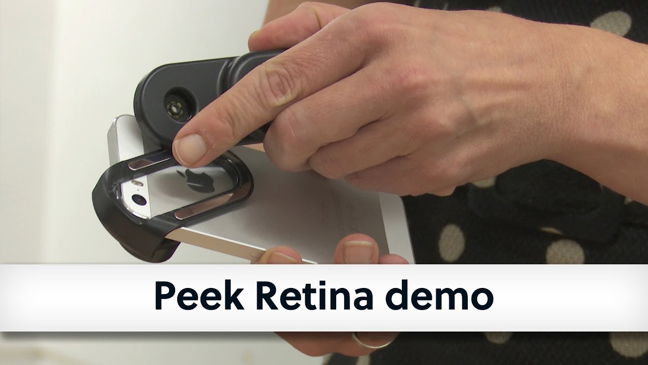 Peek Retina demo - YouTube