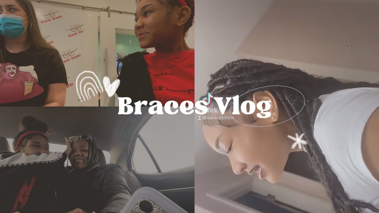 Braces Vlog Youtube