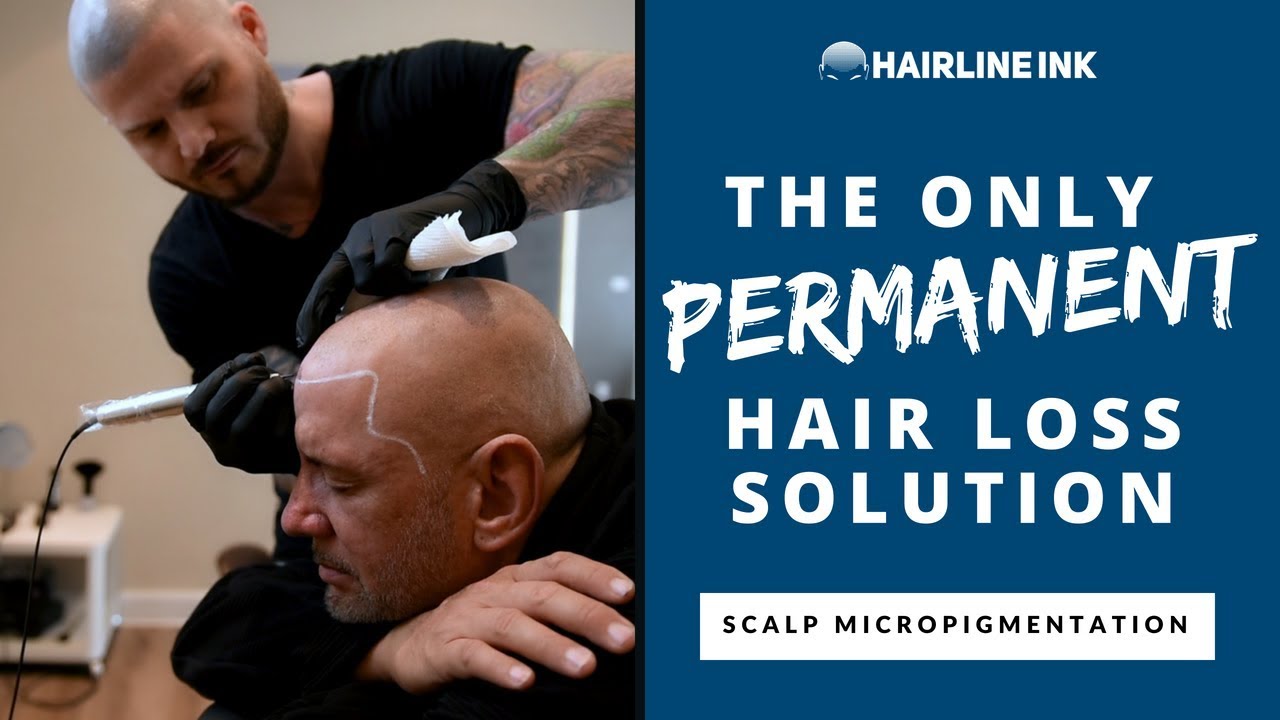 The Only PERMANENT Hair Loss Solution, by Hairline Ink - YouTube