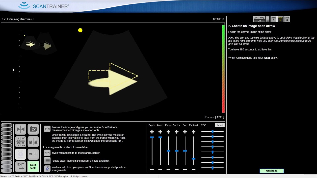 ScanTrainer Probe Manipulation Skills - YouTube