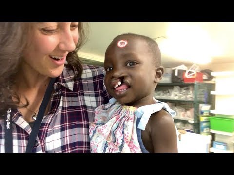 Mahamat's Cleft Lip & Palate Surgery -- My Mercy Ship Adventure #41 ...