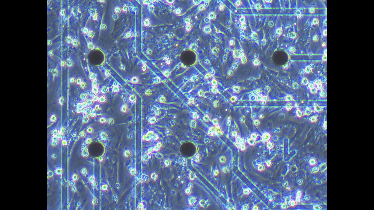 Cardiac Myocyte Cells - YouTube