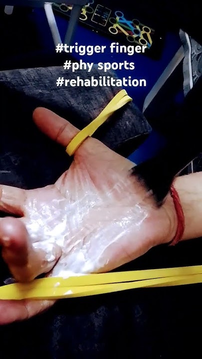 Trigger Finger Rehabilitation Drkamaal Fitness Lucknow Physports