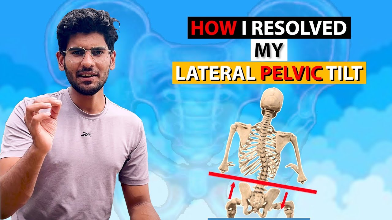 How I resolved my Lateral Pelvic Tilt - YouTube