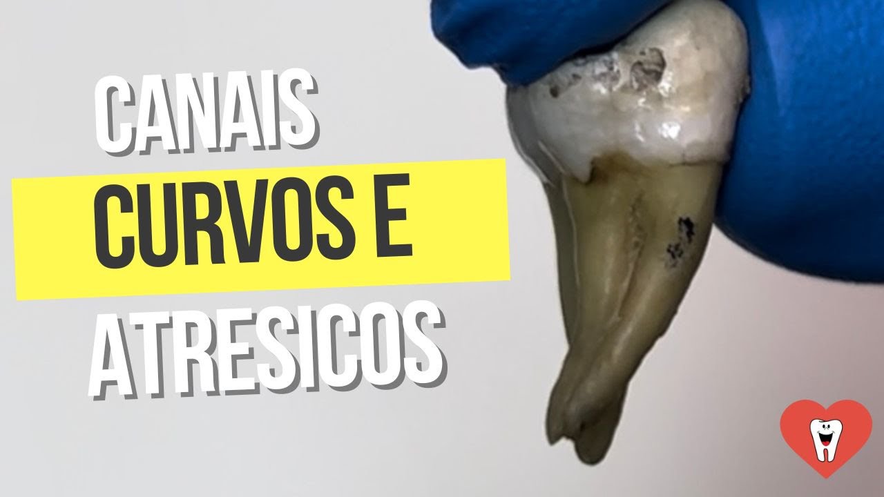 2 PASSOS PARA TRABALHAR CANAIS CURVOS E ATRÉSICOS [ESQUEMATIZADO] - YouTube