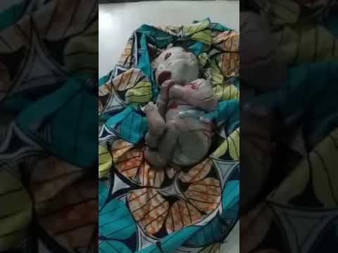 Strangest baby born: #Alien like baby born in Nigeria ( The Nomo/ # ...