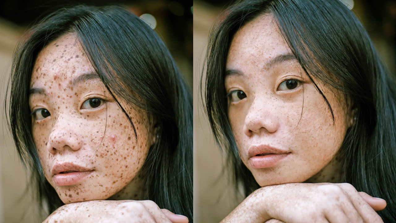 Quick and Easy Complex Blemish Removal in Minutes: No Plugins Needed ...