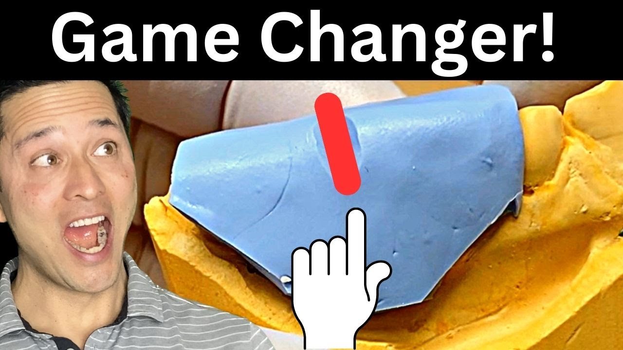 Temporary Dental Crown - 3 Tips for Easy Stent {Matrix} Fabrication ...