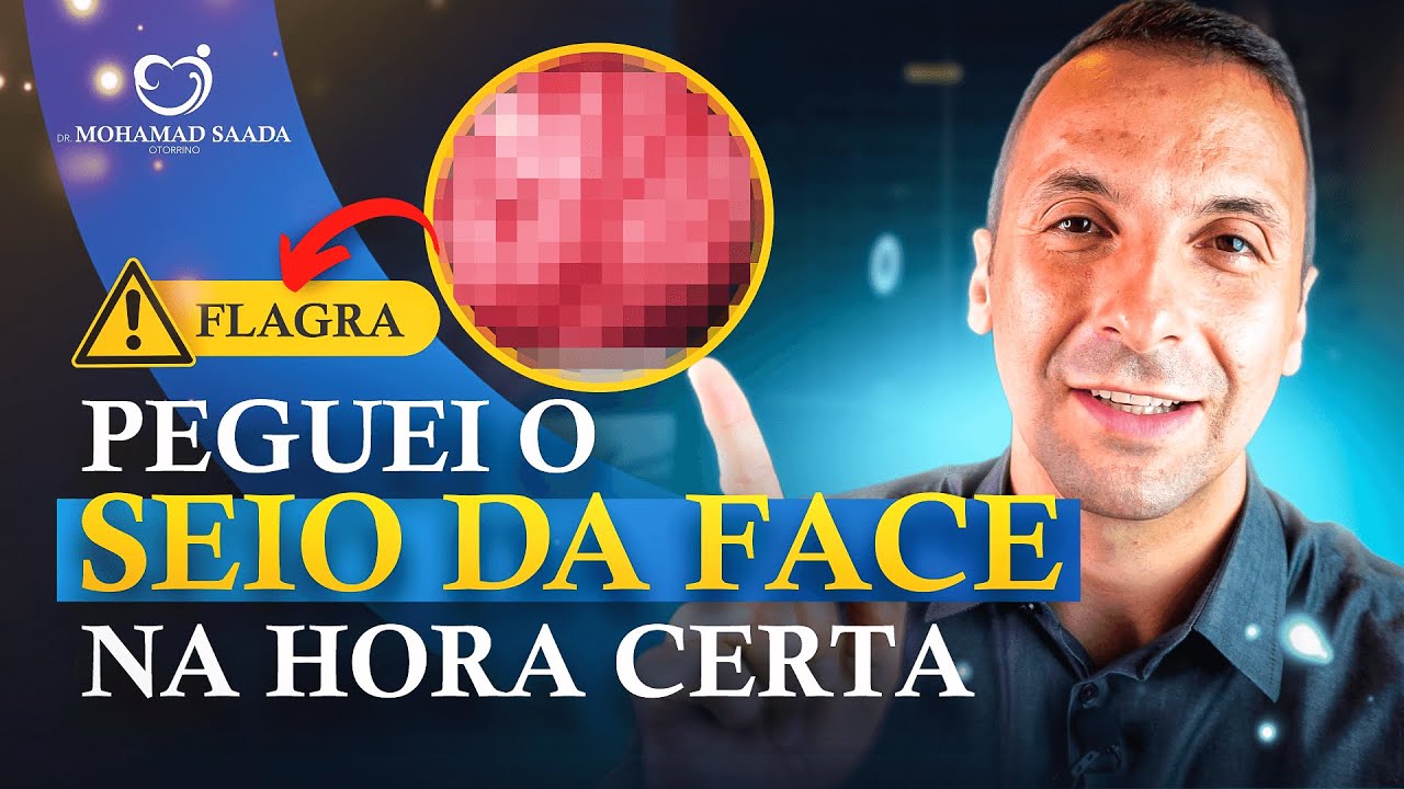 AUTO LIMPEZA DO SEIOS DA FACE - YouTube