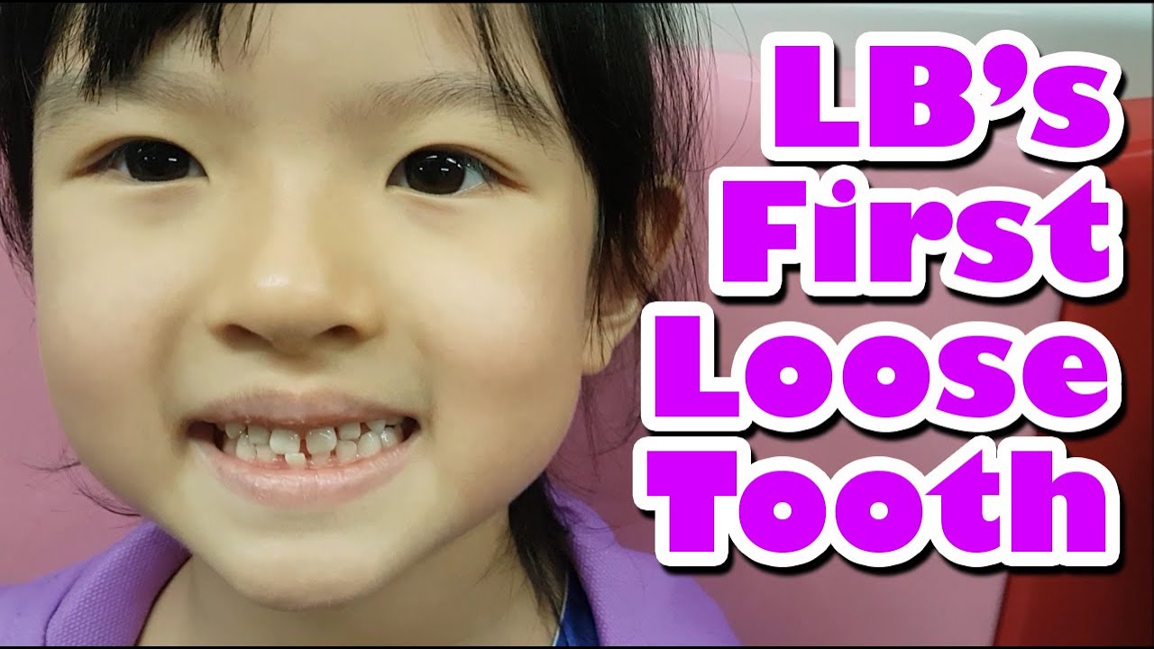LB's First Loose Tooth @ 5y9m (Lower Central Incisor) - YouTube