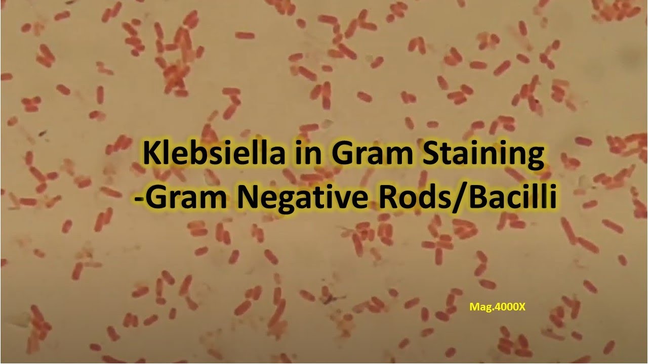 Klebsiella pneumoniae in Gram Staining of Culture - YouTube