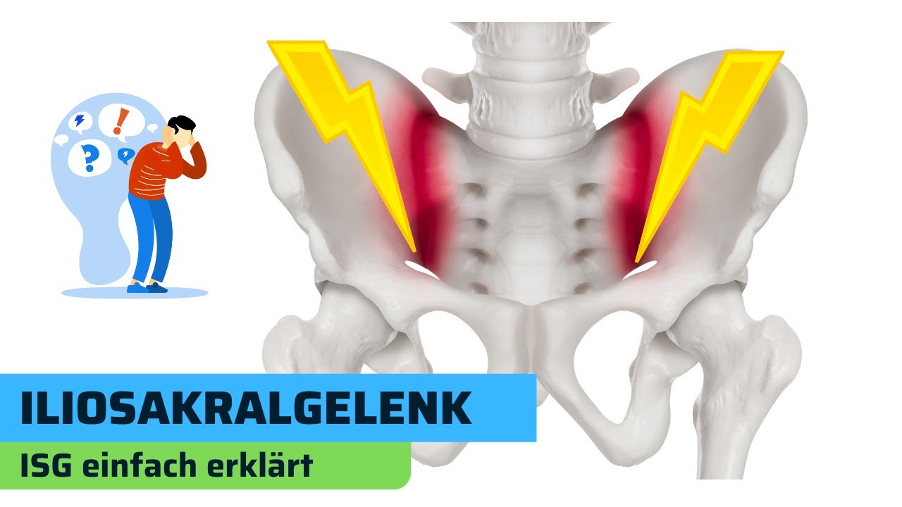 Iliosakralgelenk (ISG): Grundlagen bei Rückenschmerzen - YouTube