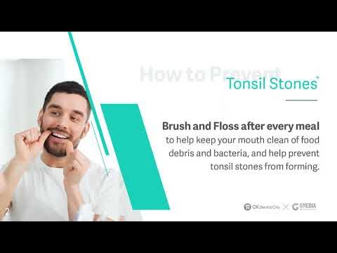 [CK Dental City] Storytelling: How to Prevent Tonsil Stones - YouTube