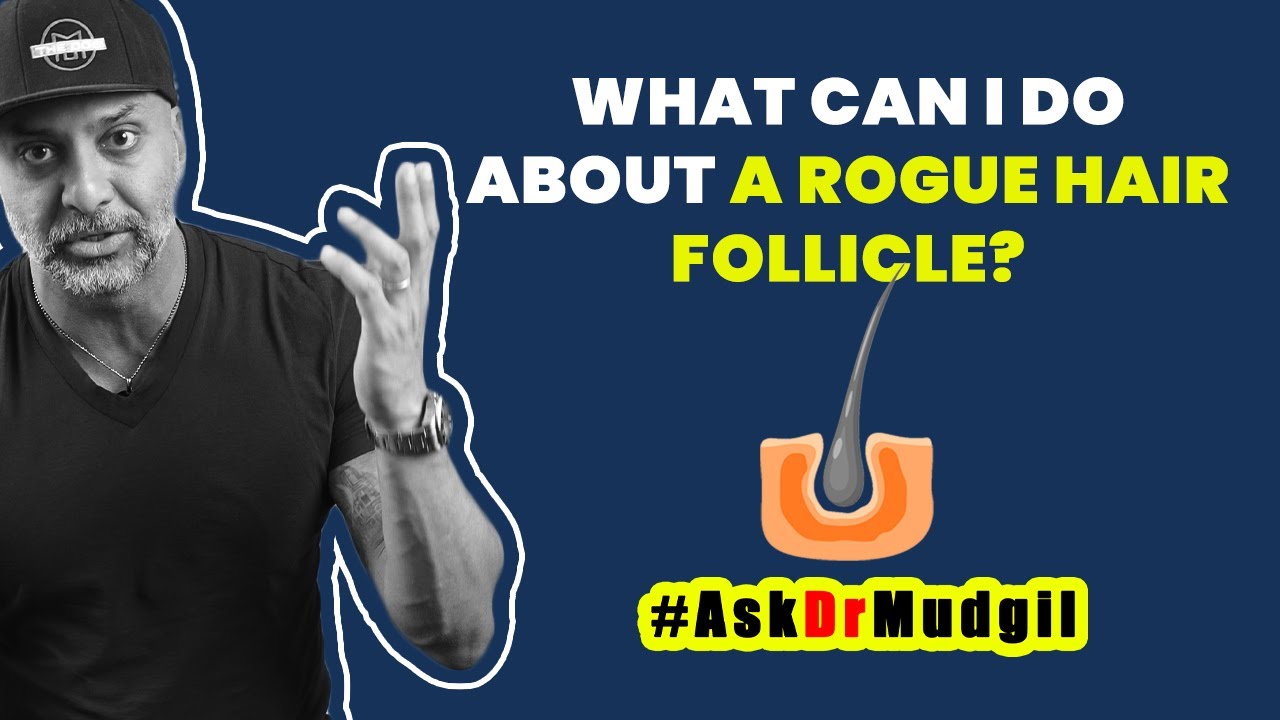 WHAT CAN I DO ABOUT A ROGUE HAIR FOLLICLE? - YouTube