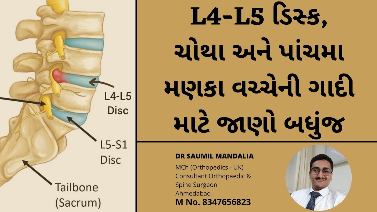 જાણો L4-L5 સ્લીપ ડિસ્ક/ ચોથા અને પાંચમા મણકા વચ્ચેની ગાદી માટે બધુંજ ...