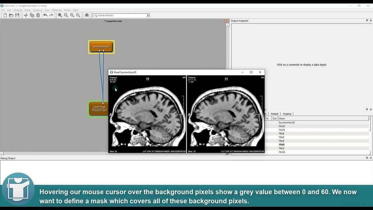 MeVisLab Tutorials - Image Processing - Image Masks - YouTube