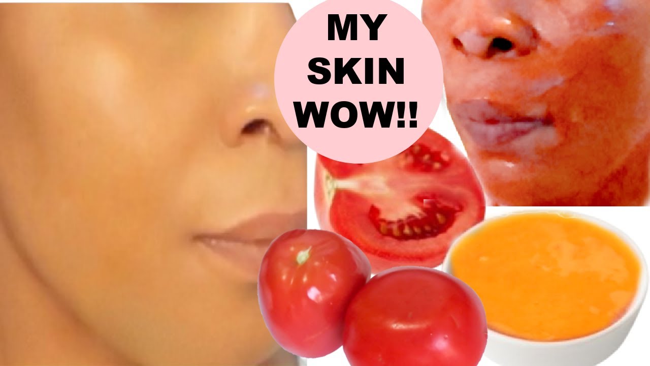 I USE TOMATO ON MY SKIN AND LOOK WHAT IT DID TO MY SKIN, LIGHTEN ...