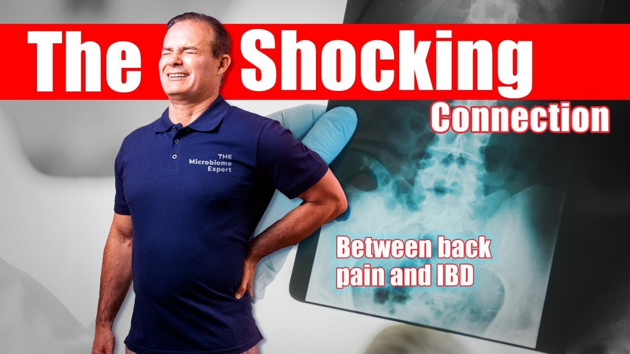 Do You Have Lower Back Pain and Crohn’s Disease or Ulcerative Colitis ...