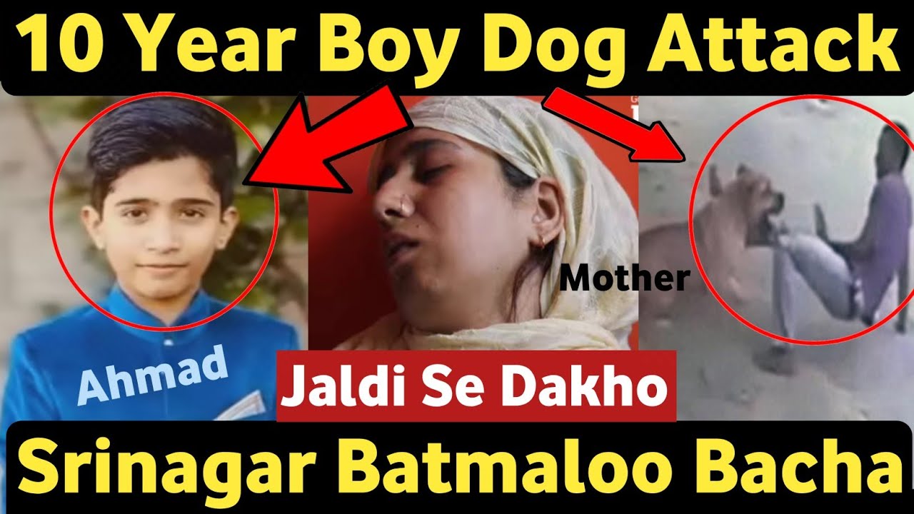 Dog Attack With Boy | Srinagar Batmaloo Ma 10 Year Ladka Ka Sath Kha ...