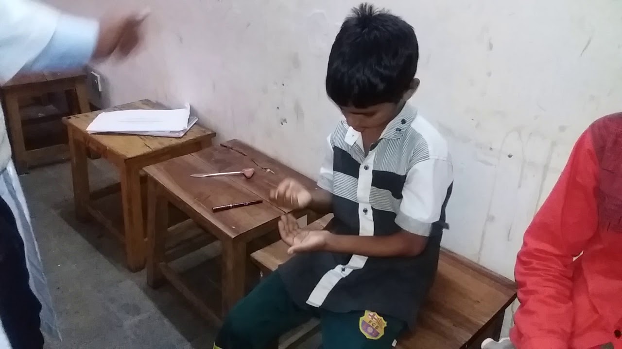 Dysdiadochokinesis\ Rapid alternating movements in Spinocerebellar ...