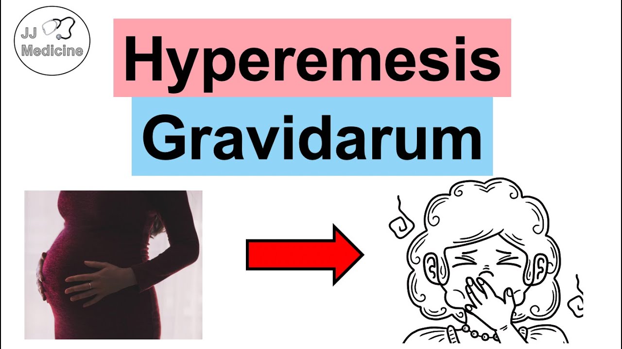 Hyperemesis Gravidarum Pregnancy Nausea Risks Symptoms Hyperemesis Gravidarum Pregnancy Nausea Risks Symptoms