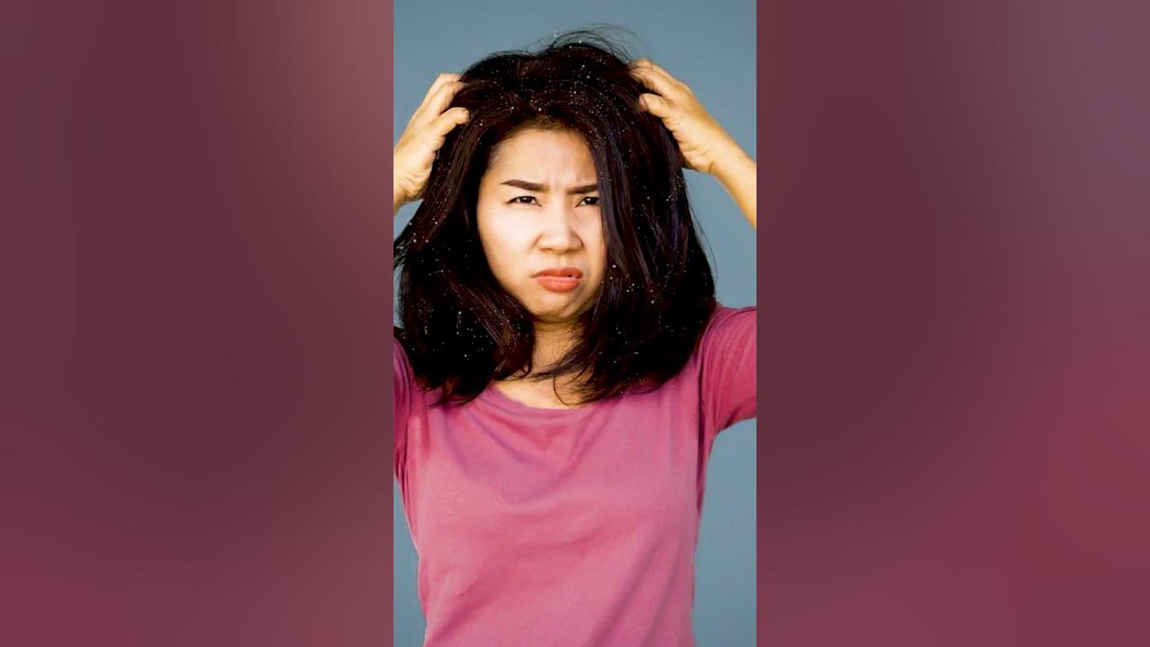 Herbal Wash For Hair Dandruff Treatment At Home How To Get Rid Of