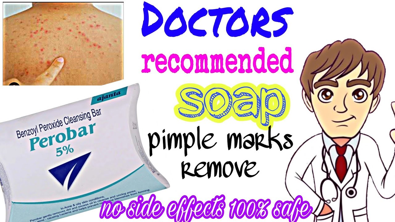 perobar 5% soap Benzoyl peroxide for acne//మొటిమలు మరియు ...