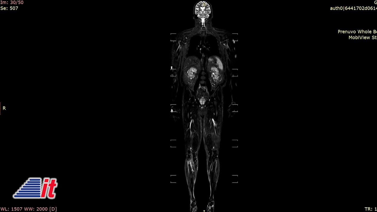 Prenuvo Whole Body Ai-Assisted Scan | Into Tomorrow - YouTube