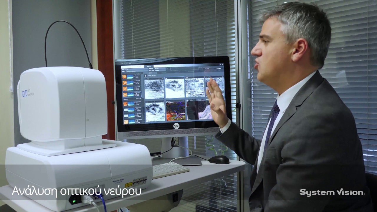 Συγχρονη Οπτική Τομογραφία Συνοχής και Ψηφιακή Αγγειογραφία (OCT-A ...