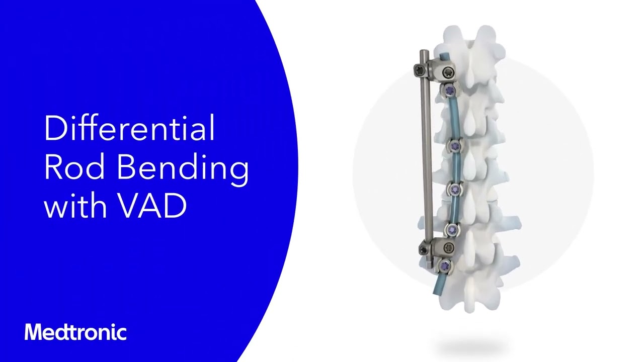 CD Horizon™ Solera™ Spinal System + Dual Rod Multi-Axial Screw (DRMAS ...