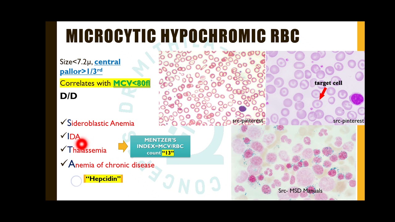 RBC MORPHOLOGY COMPILATION - PART 1 - YouTube