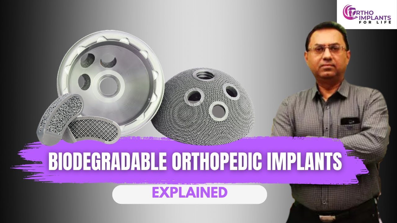 Biodegradable Orthopedic Trauma Implants Explained: Future of Trauma ...