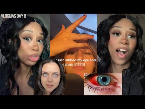 SHE RUBBED HER EYE AND THIS HAPPEND!!THE CRAZIEST THING IVE EVER SEEN! FUN FACT , REACTION VLOGMAS 8