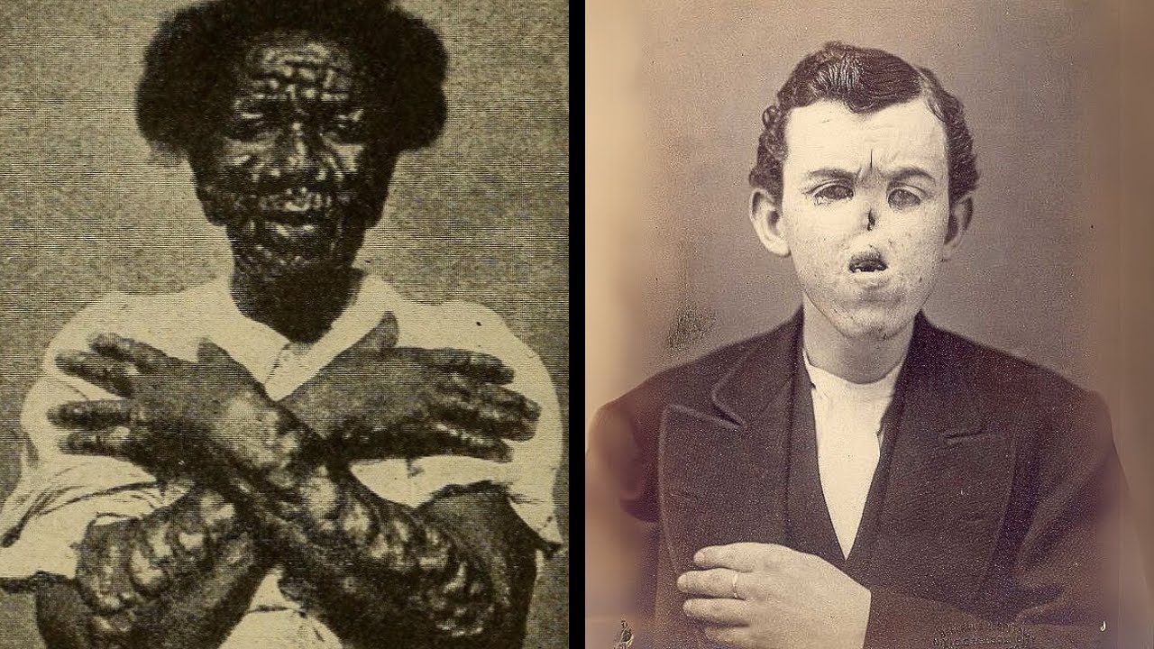 15 Disturbing Human Circus Freaks That Actually Exist - YouTube