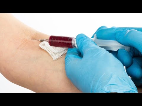 Blood collection Method 1- Open collection- safe Technique - syring ...