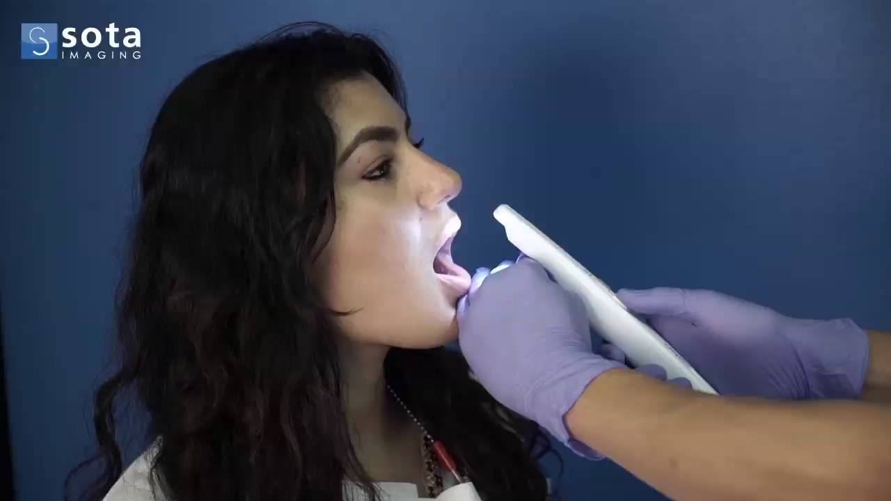 Claris® i4D Intraoral Camera – How to Take Crystal Clear Images - YouTube