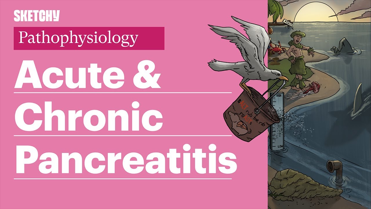 Acute vs Chronic Pancreatitis: Causes & Treatments (Part 1) | Sketchy ...