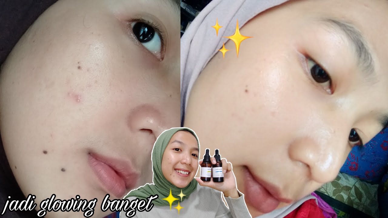 REVIEW SERUM ALL PERFECT | Whitening Serum & Fresh Calming Serum ...