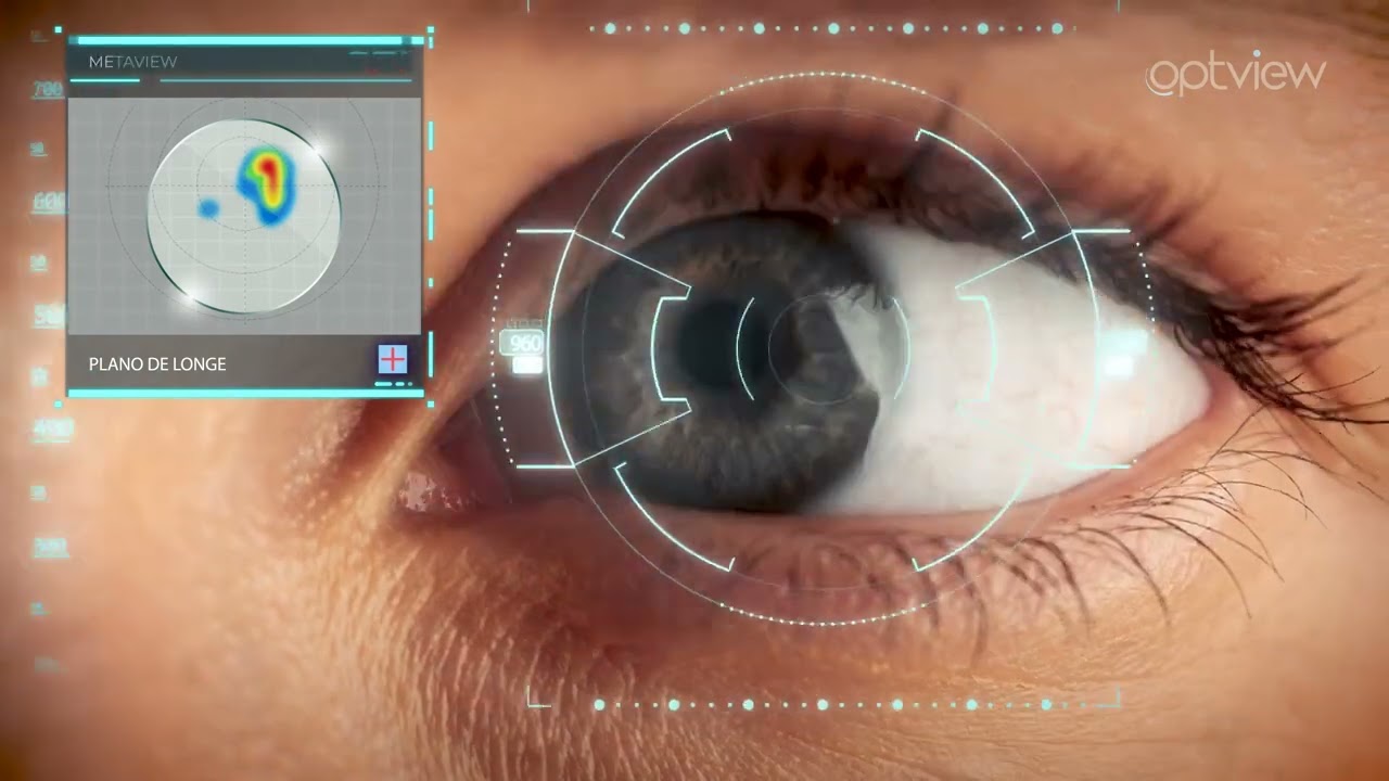 Tecnologia MetaView - YouTube