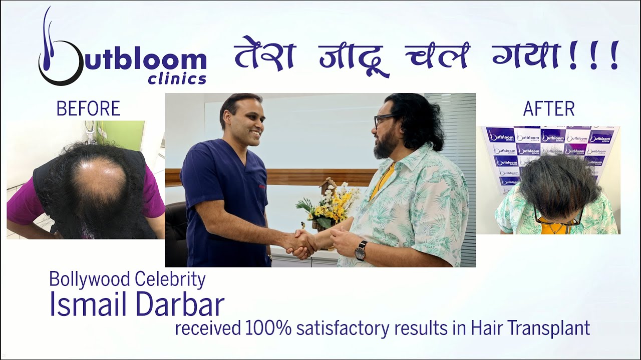 ismail darbar hair transplant results/ best hair transplant jaipur/ dr ...