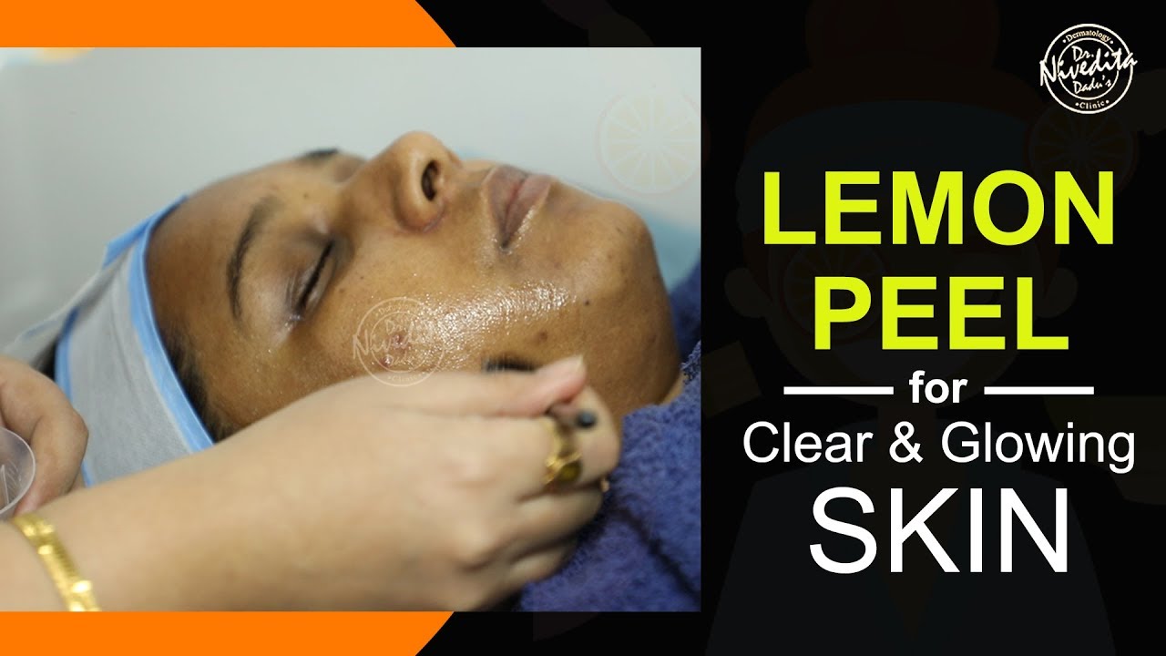 Lemon Peel to reduce Dark Spots & Pigmentation | Treats Uneven Skintone ...